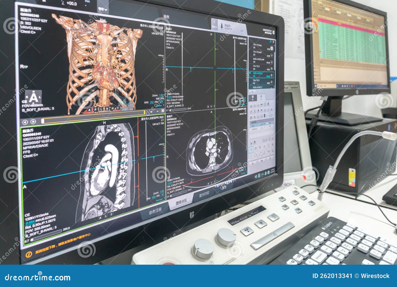 Doctor Analyzing the Test Results from MRI Scanner on the Computer ...