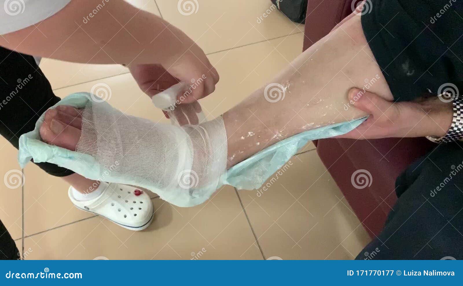 The Doctor Bandages the Leg of the Patient. Plaster Cast on a Broken ...