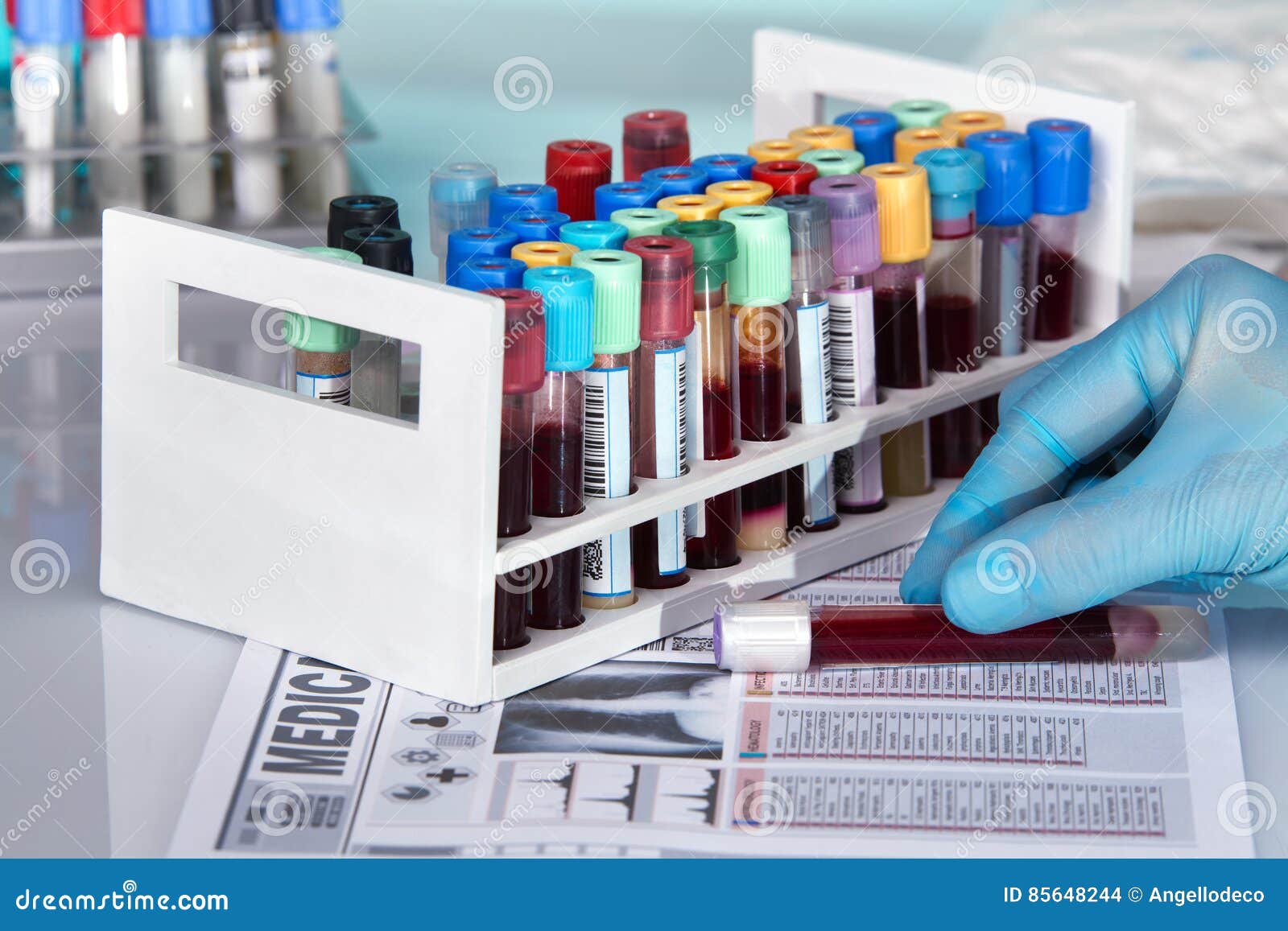 Doctor with Blood Samples in the Laboratory Stock Photo - Image of ...