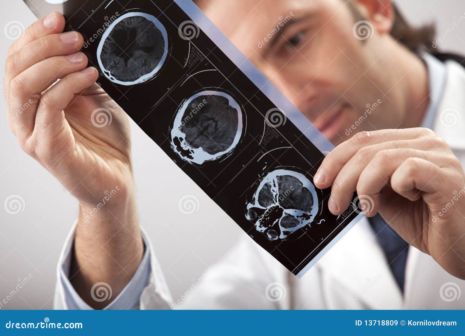 Doctor is checking x- ray stock image. Image of check - 13718809