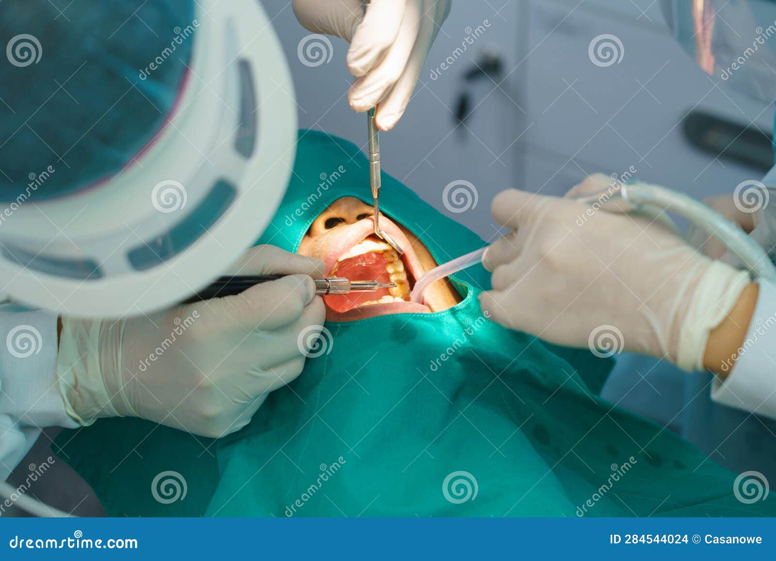 Doctor Cleaning the Teeth Patient with Ultrasonic Tool Stock Photo ...