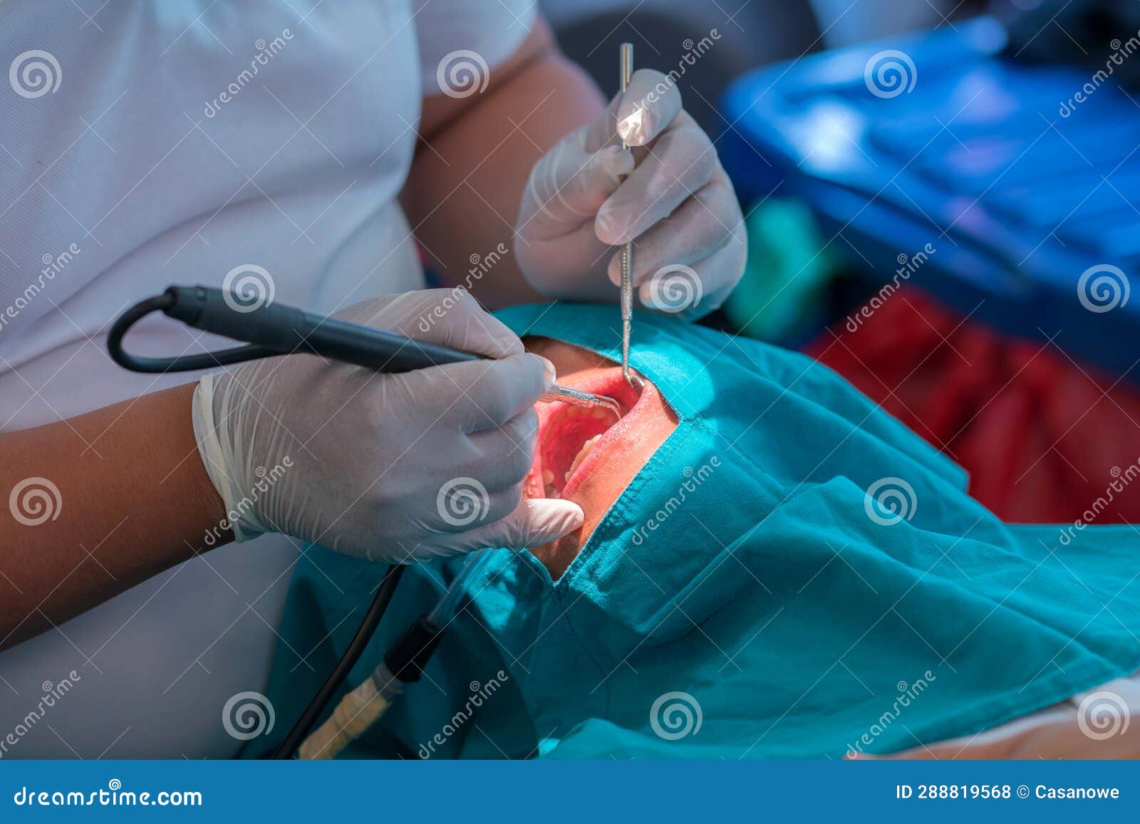 Doctor Cleaning the Teeth Patient with Ultrasonic Tool Stock Photo ...