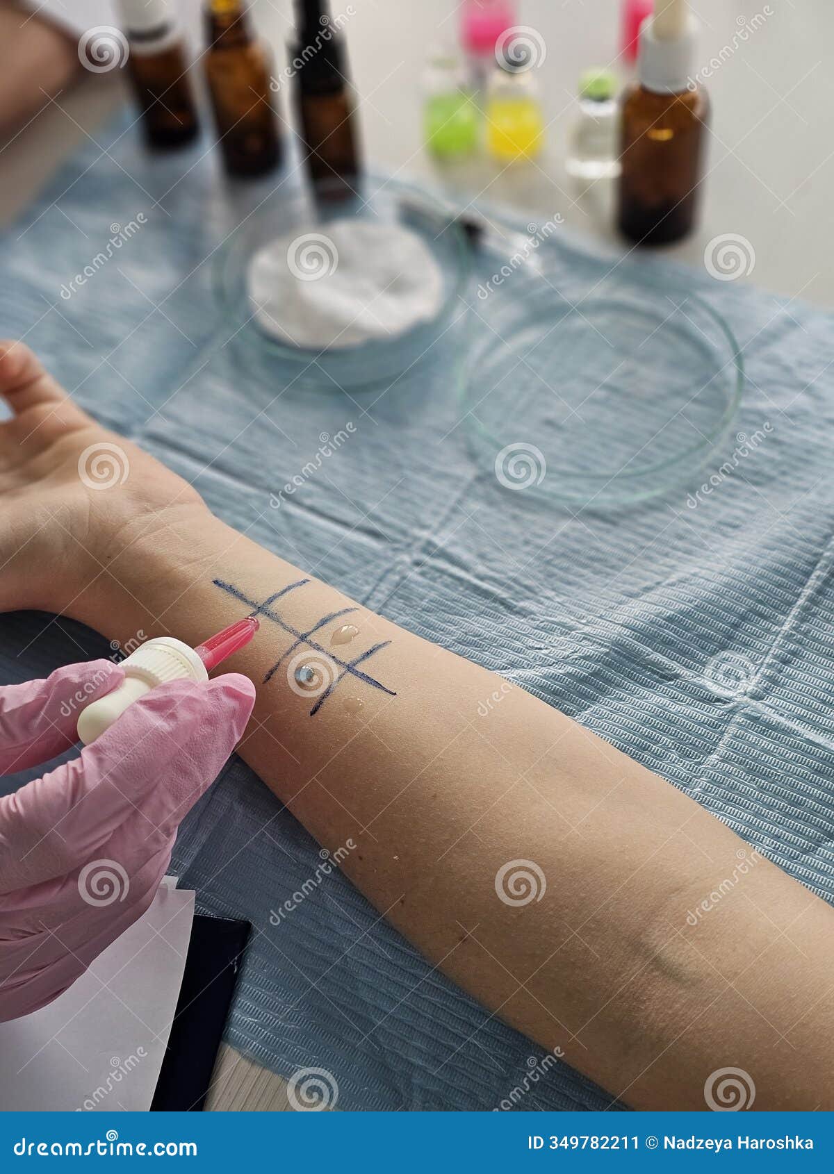 Doctor Doing Wound Dressing Care, Hand Surgery Treatment, Trigger ...