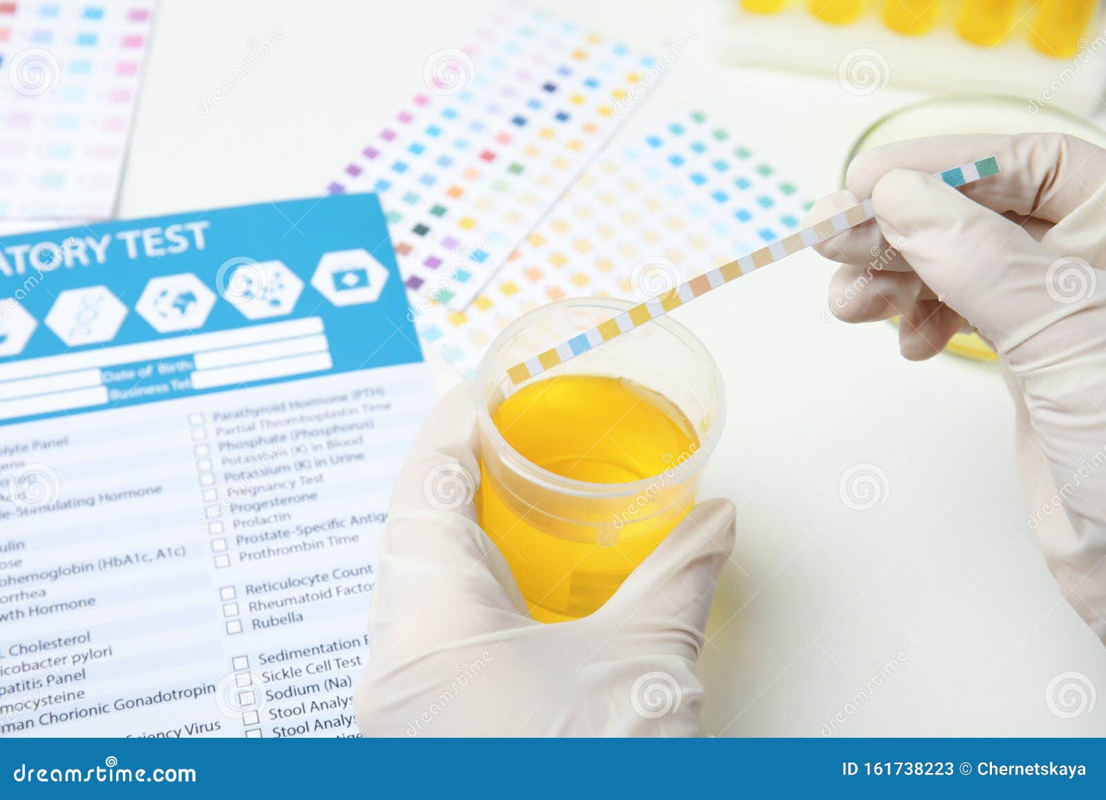 Urine Analysis Test Strips Close Up Royalty-Free Stock Photography ...