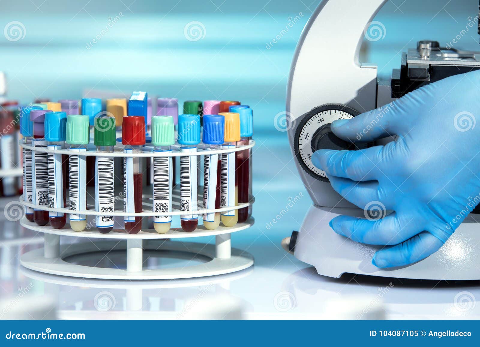 Doctor Examining in the Microscope Sample of Blood Test in the L Stock ...