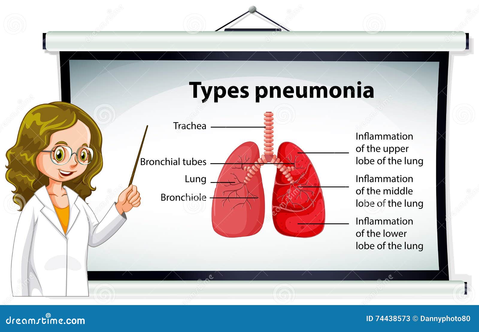 Pneumonia Cartoons, Illustrations & Vector Stock Images - 74075 ...