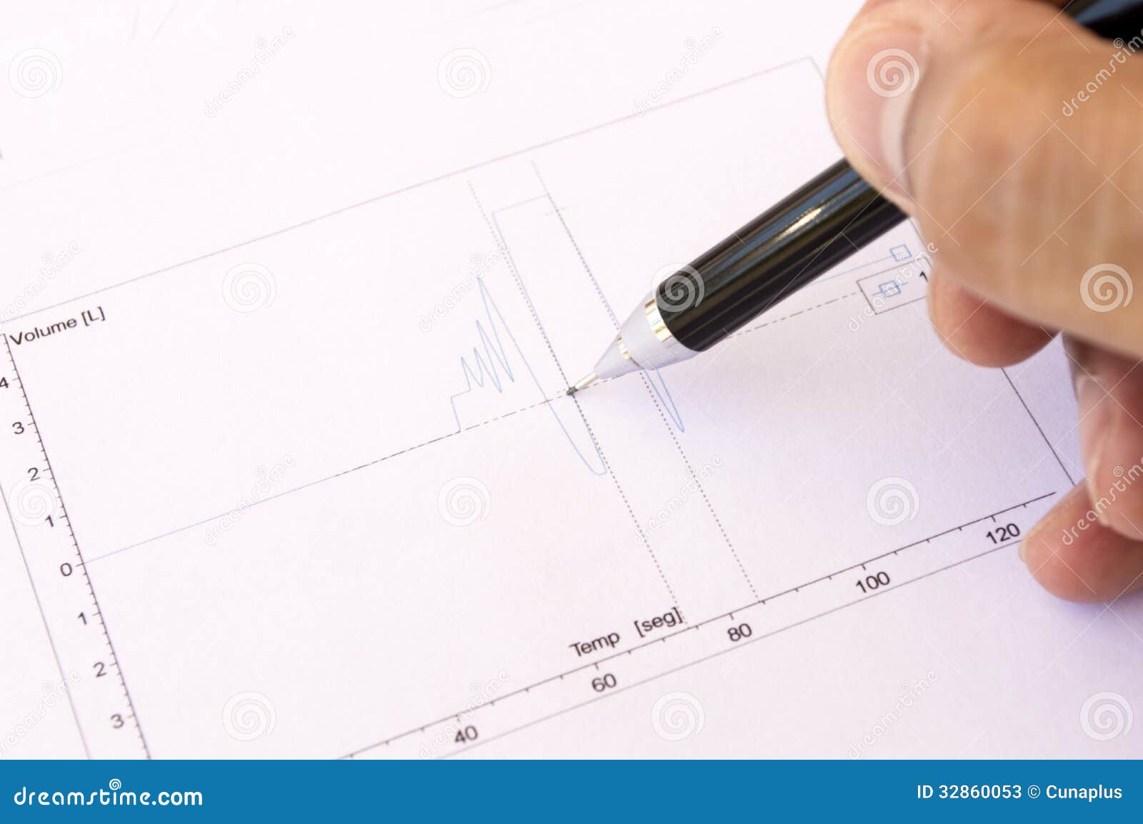 Doctor Graph Analyzing Electrocardiogram Stock Image - Image of ...