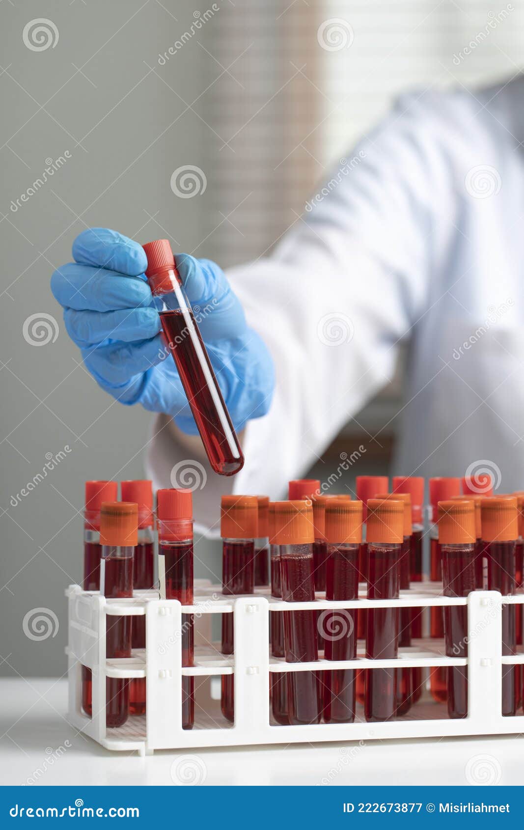 Doctor Hand Taking a Blood Sample Tube Stock Image - Image of disease ...