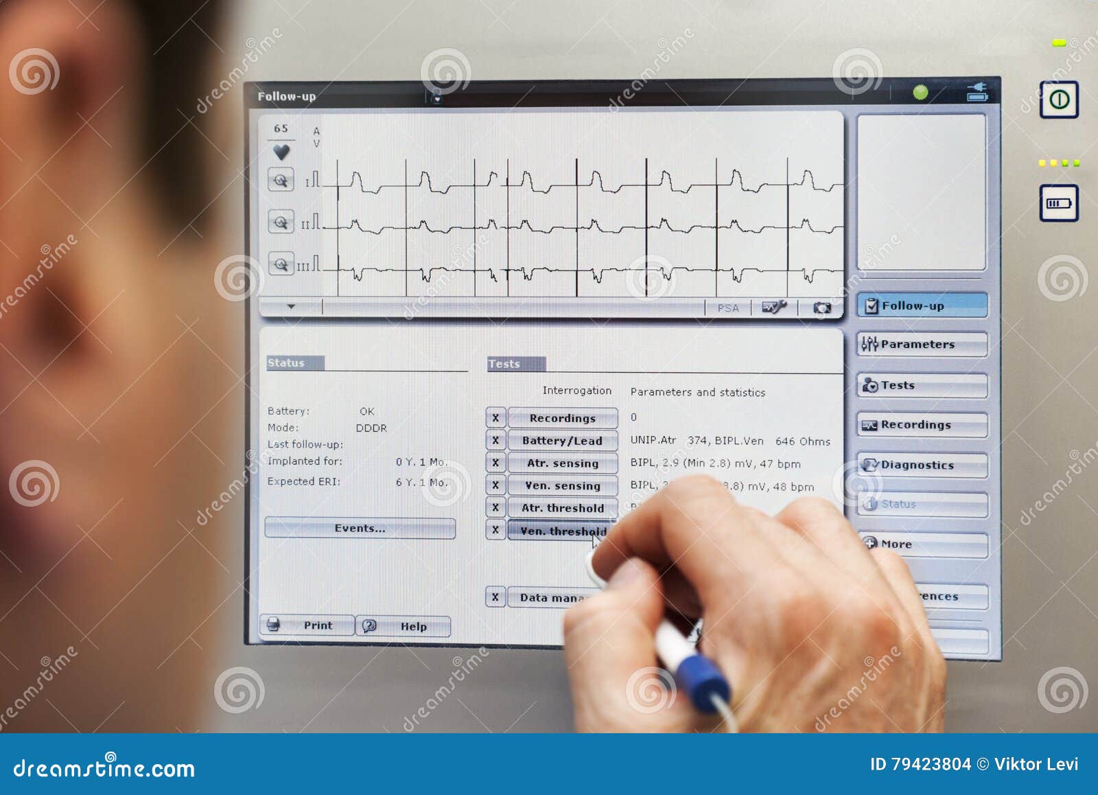 Doctor Heart Pacemaker Monitor Stock Photo - Image of parameters, heart ...