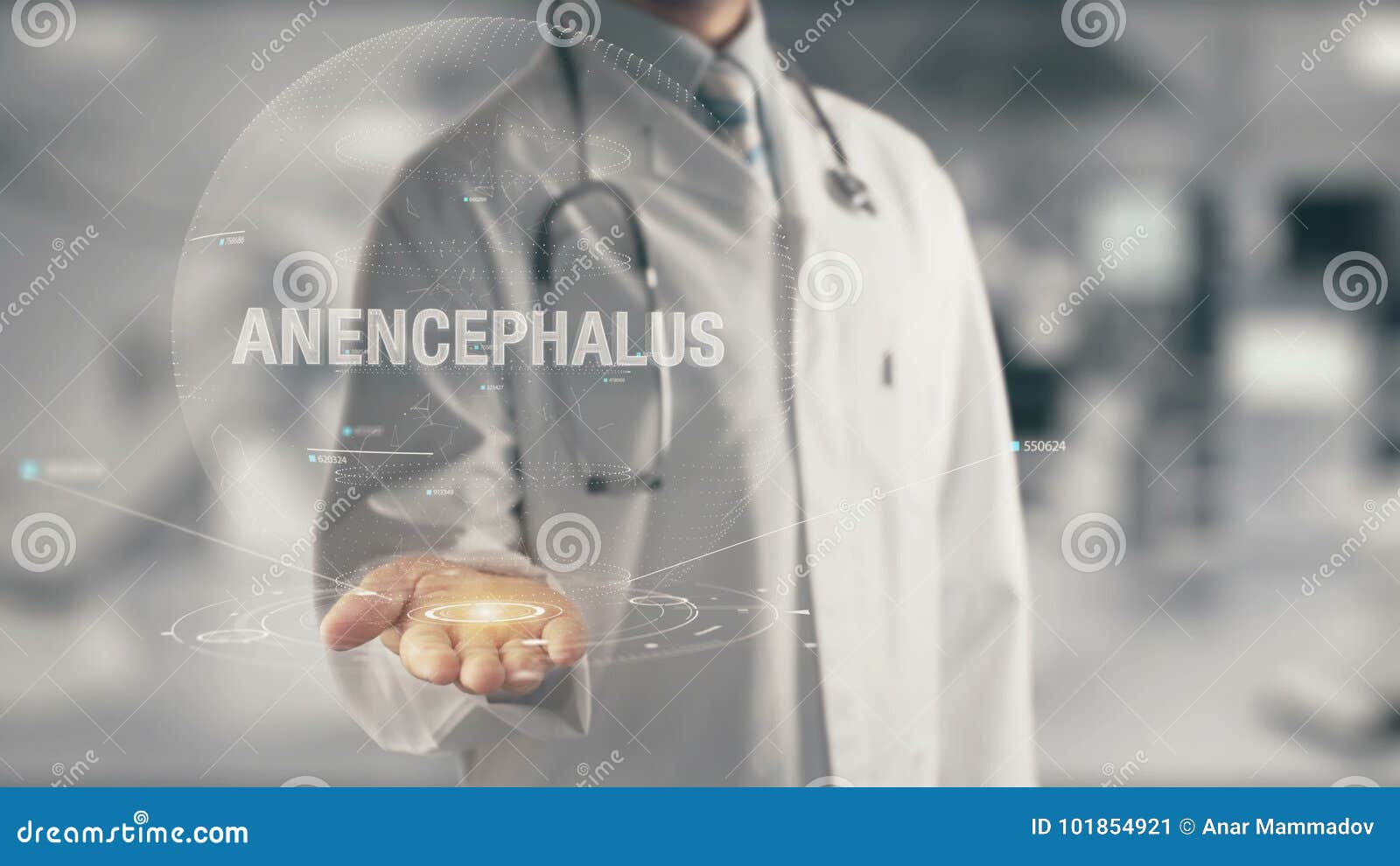 Doctor Holding in Hand Anencephalus Stock Image - Image of hand, care ...