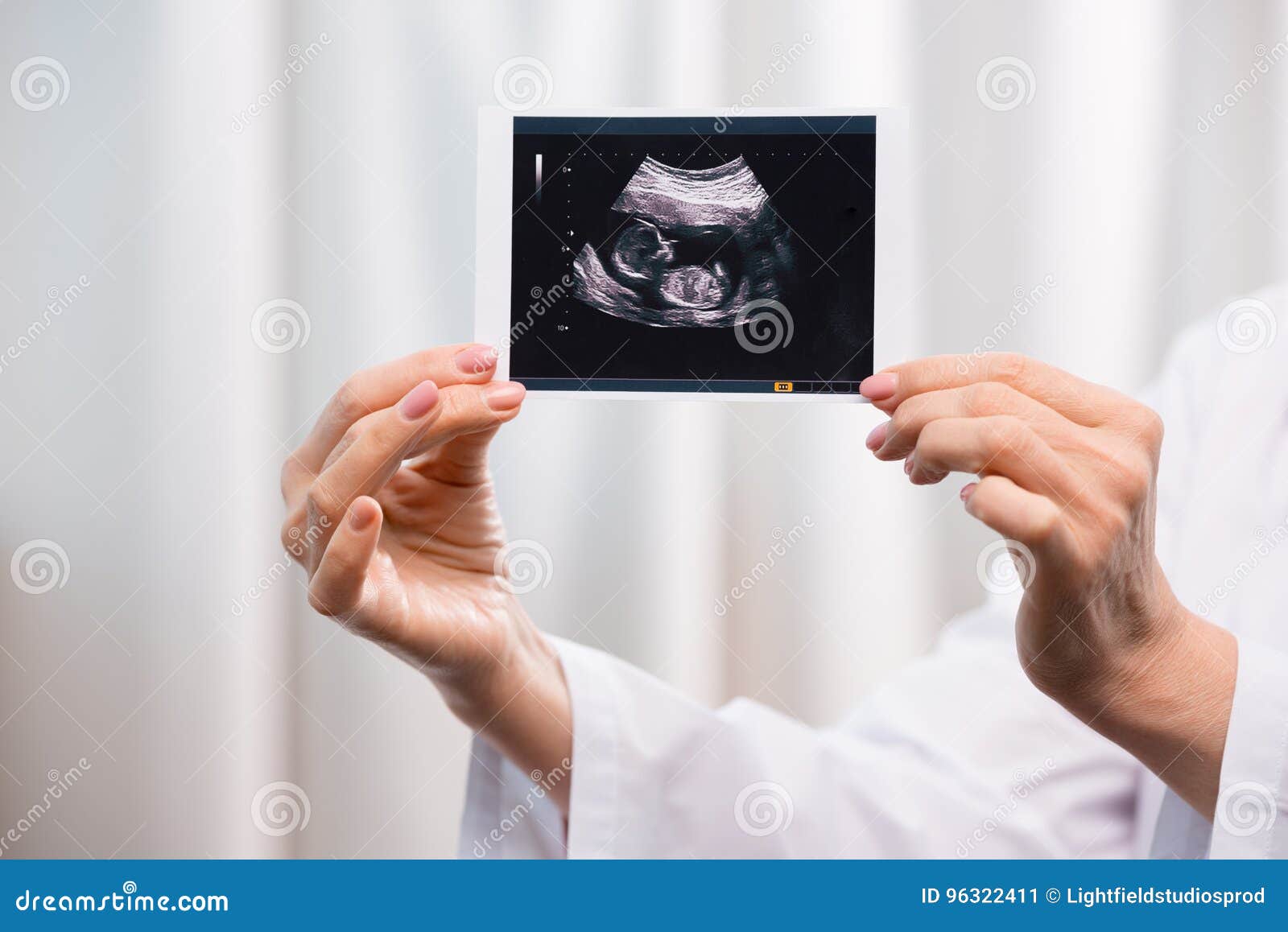 Doctor Holding Scan of Baby in Hands Stock Image - Image of woman ...
