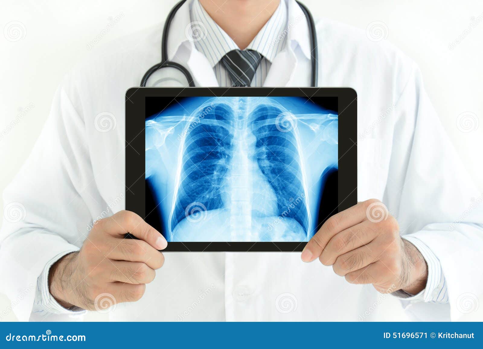 Doctor Holding Tablet Pc with Normal Male Chest X-ray Image Stock Image ...