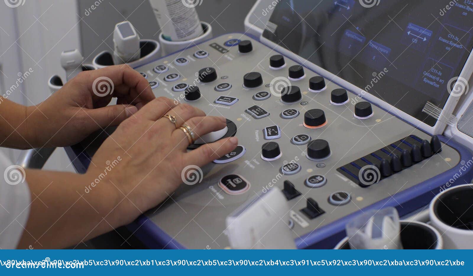 The Doctor Keeps His Hands on the Keyboard of the Ultrasound Machine ...