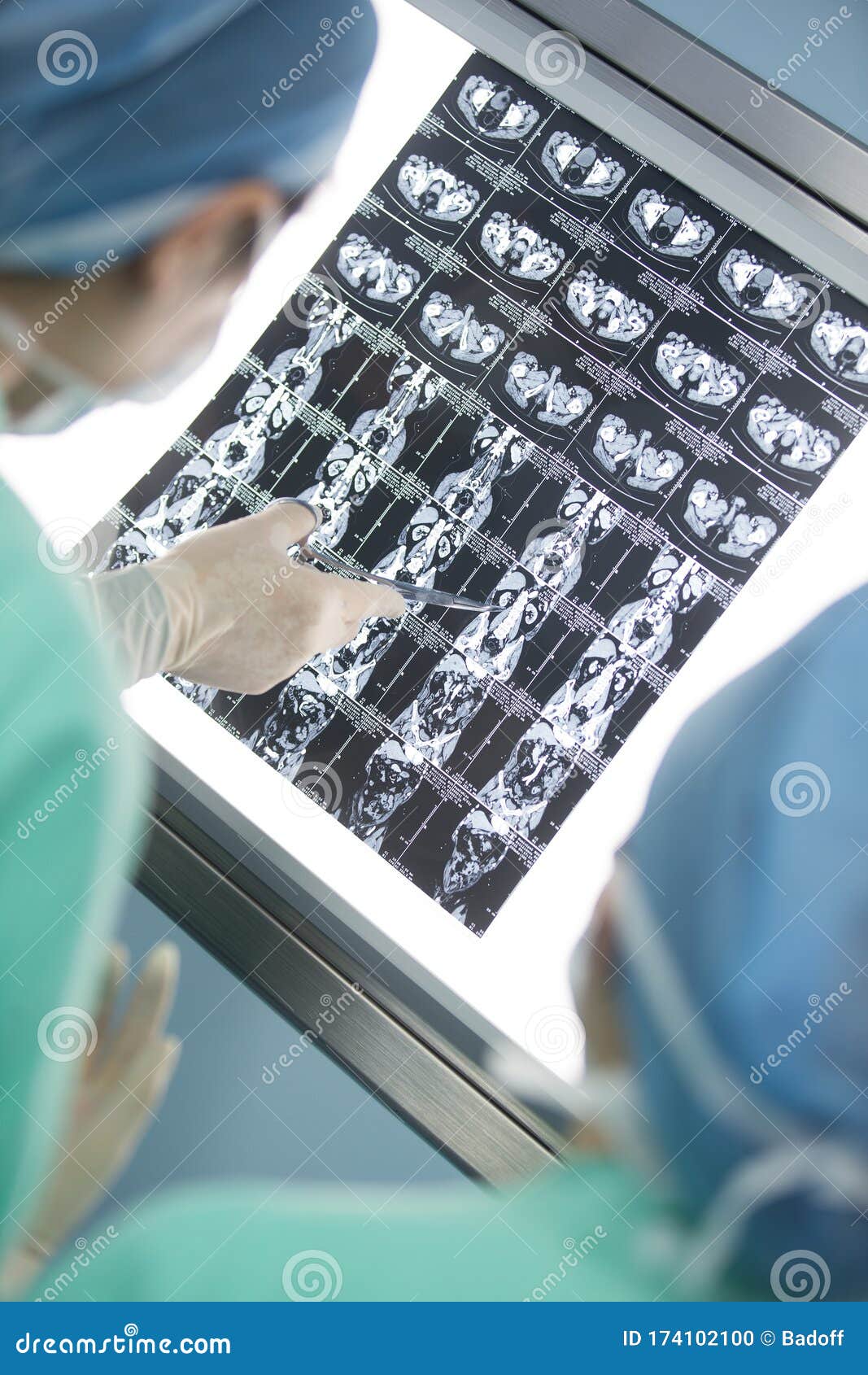 Doctor looking at ct scan. stock photo. Image of adult - 174102100