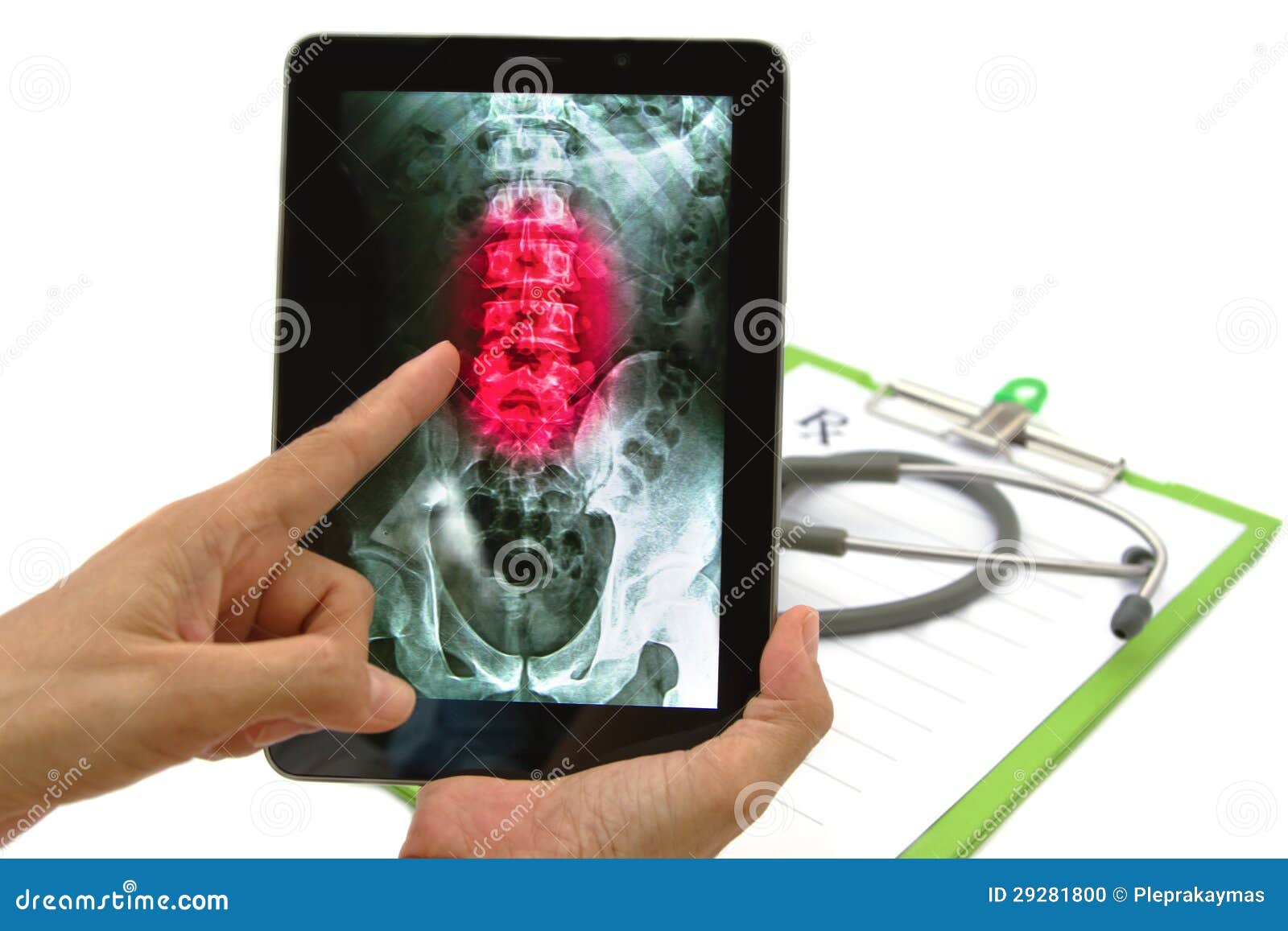 Doctor Looking Lumbar Spine X-ray Image on Tablet Stock Photo - Image ...