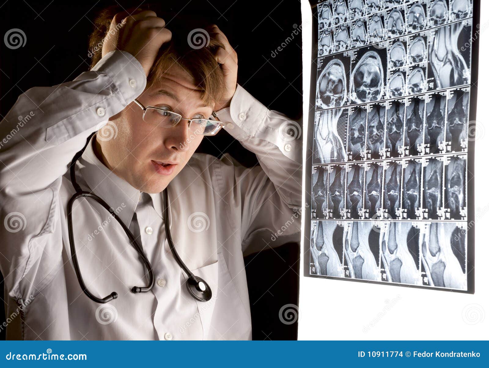 Doctor Looking at the MRI Scan with Panic Stock Photo - Image of expert ...
