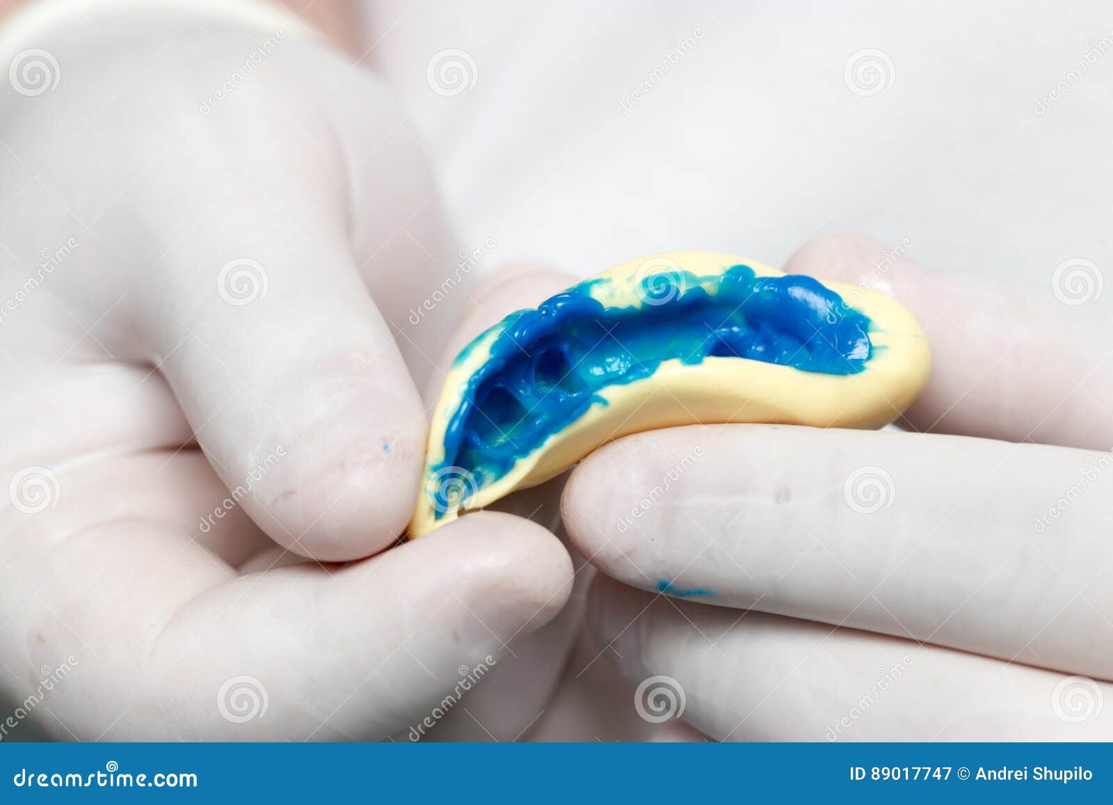 Plastic Prosthetic Foot. Exhibition Of Modern Prosthetics Technologies ...