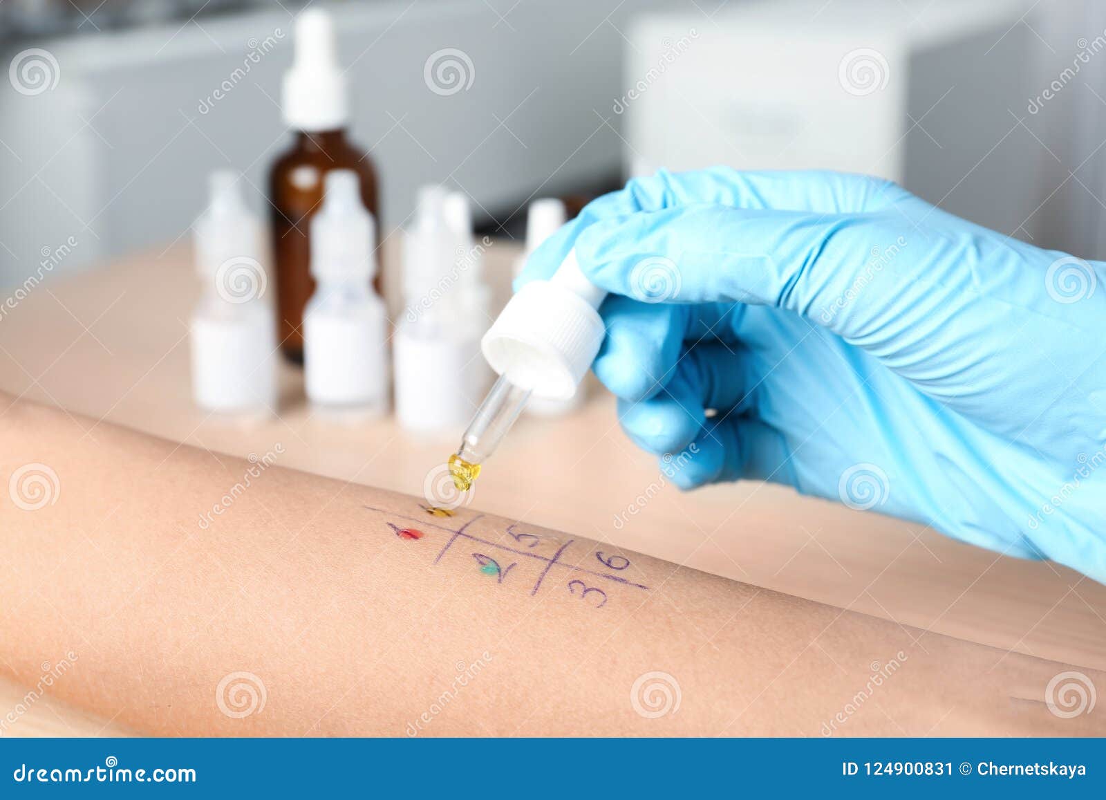 Doctor Making Allergy Test at Table Stock Image - Image of drop, adult ...