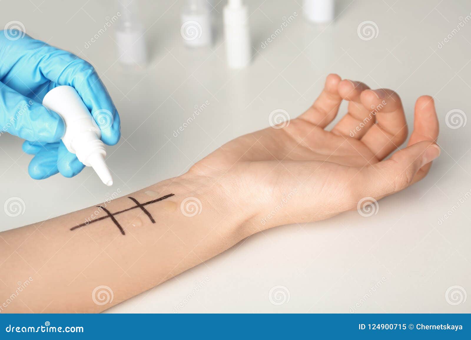 Doctor Making Allergy Test at Table Stock Image - Image of female ...