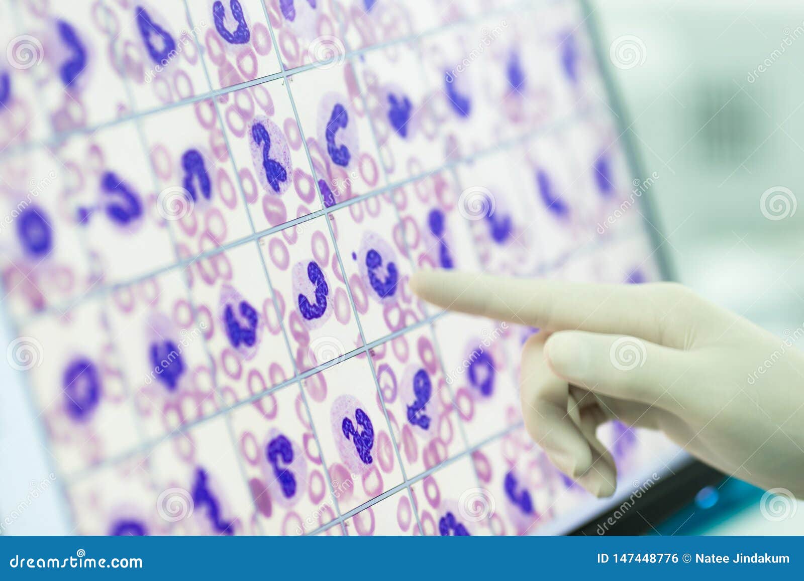 Doctor or Medical Technologist Analyzing Blood Test in Laboratory about ...