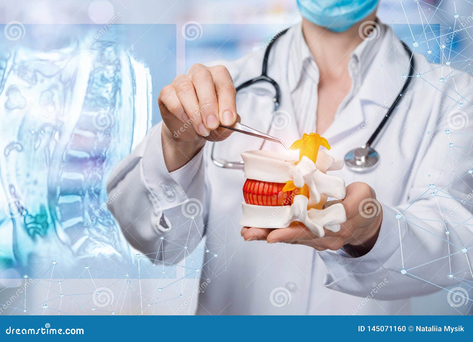 A Doctor Operating with Herniated Disc Stock Photo - Image of modern ...