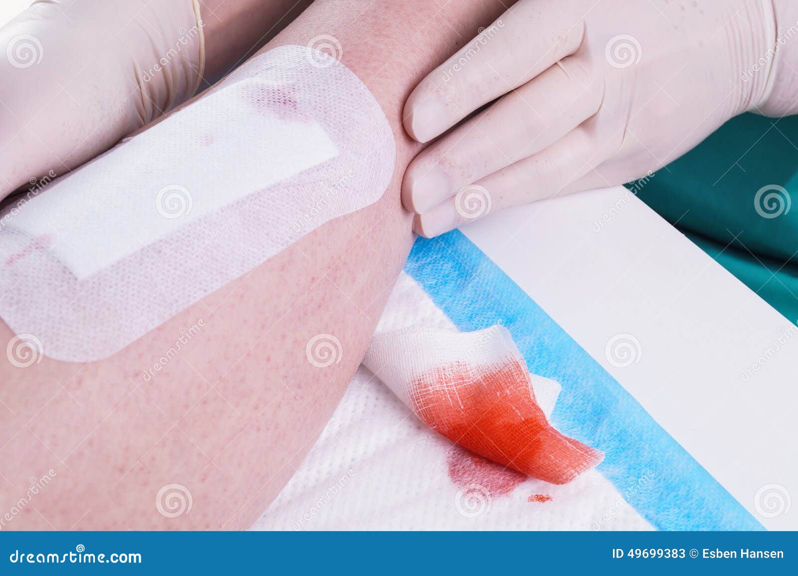 Doctor patches a Injury stock image. Image of human, hospital - 49699383