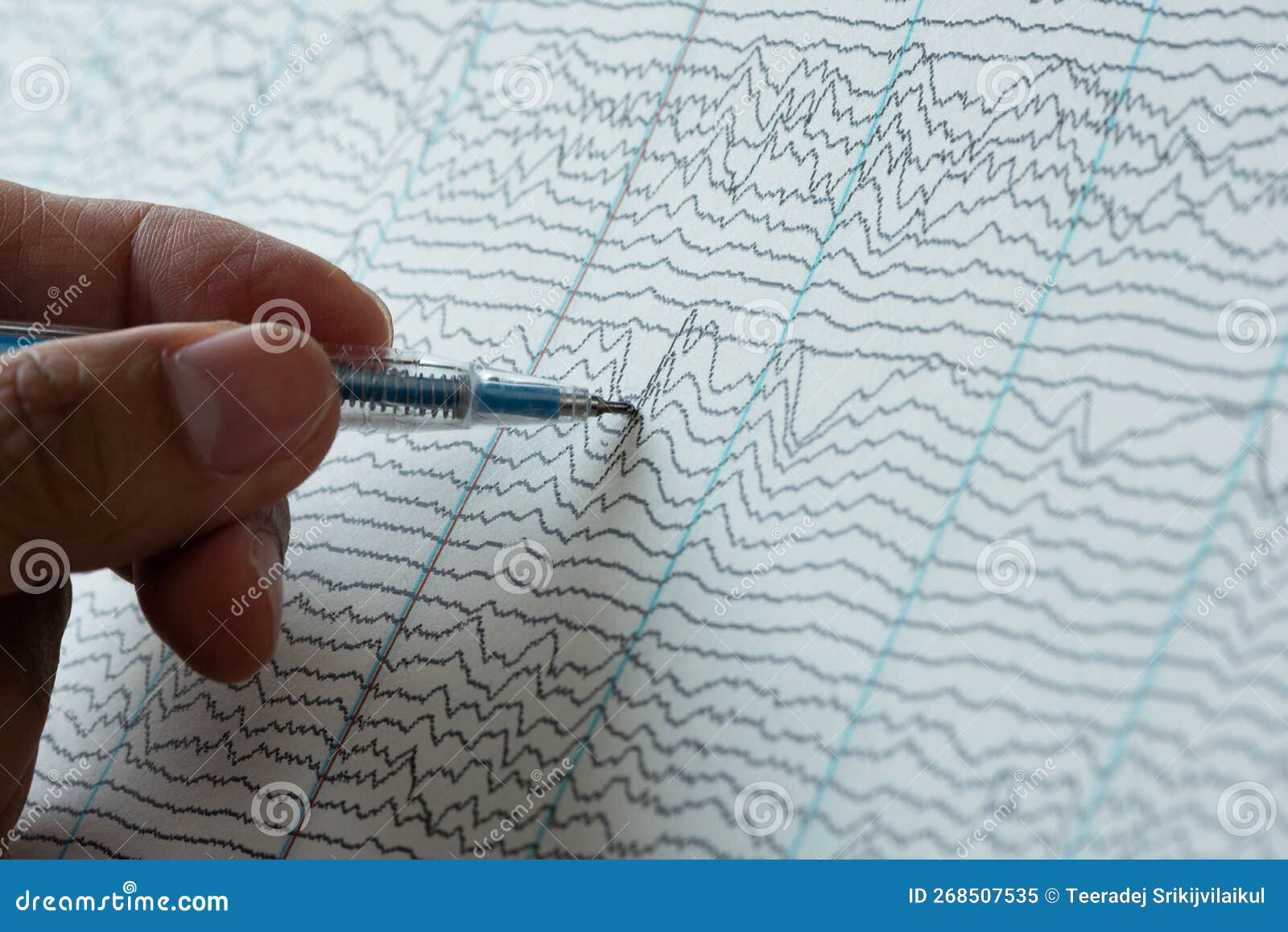Doctor Pointing at Abnormal Brain Waves Stock Image - Image of hospital ...