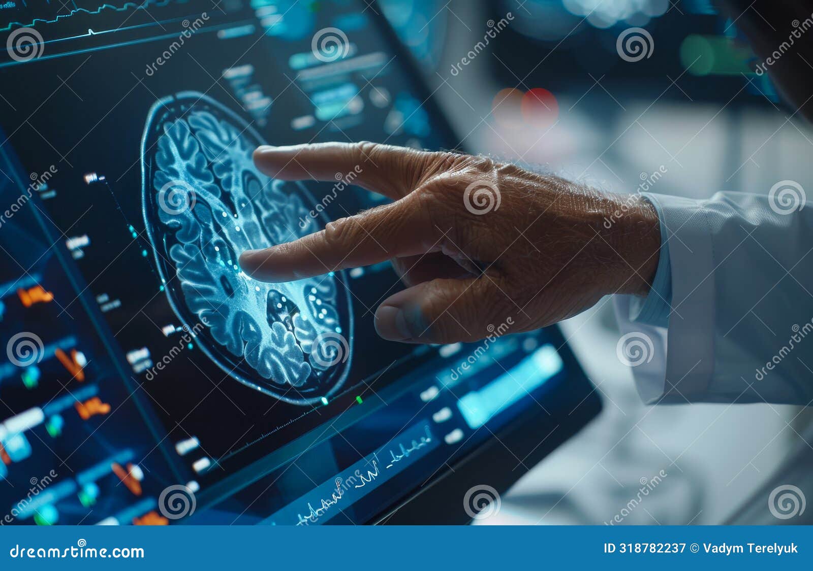 Doctor Pointing at Brain Scan on Computer Screen Stock Image - Image of ...