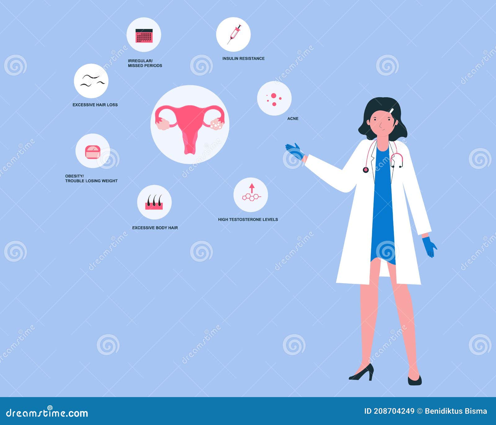 Polycystic Ovary Syndrome Pcos Hormonal Diagnose Medical Illustration