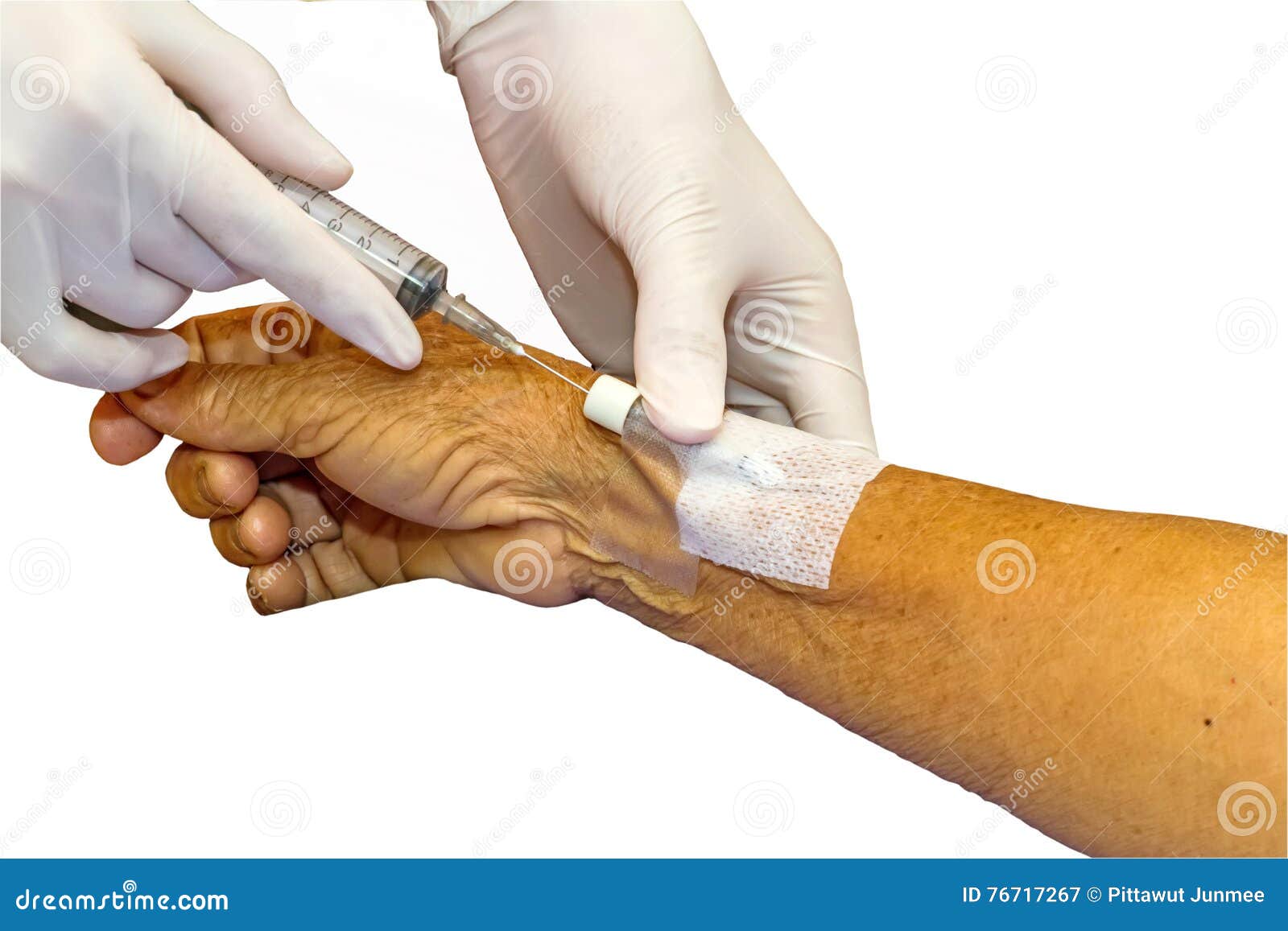 Doctor Push Syringe in Heparin Plug Hand of Patient Stock Image - Image ...
