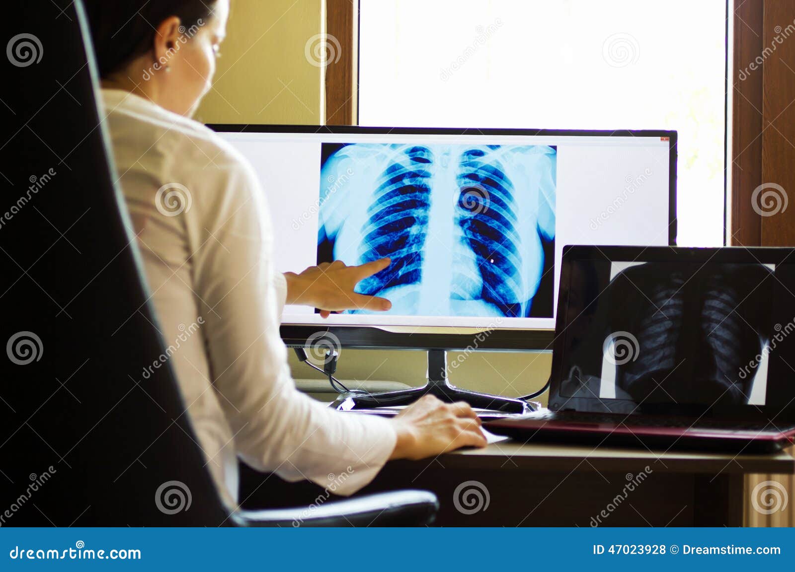 Doctor Radiographer Looking at X Ray on Computer Screen Stock Photo ...