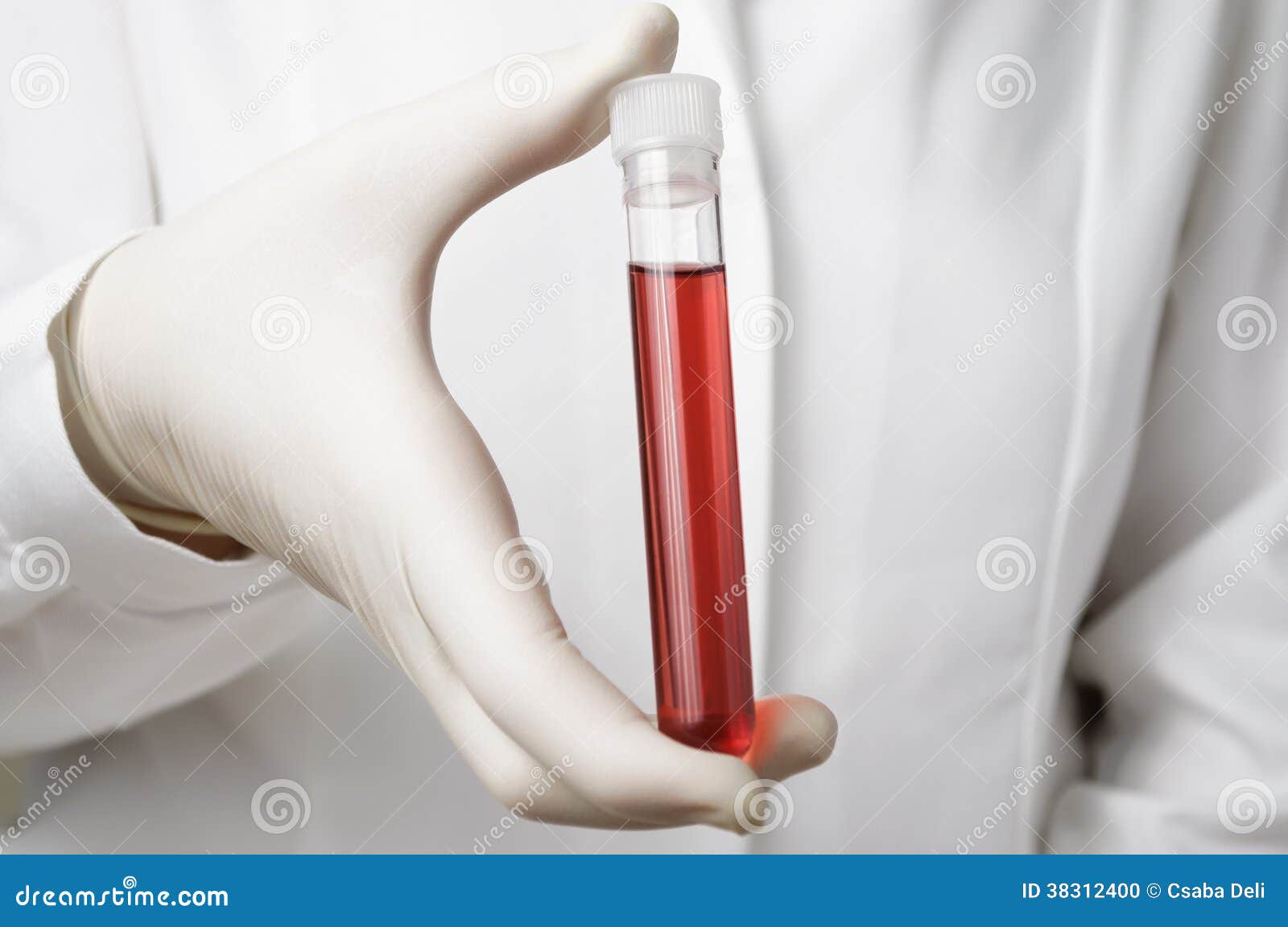 Doctor S Hand with Blood Sample Stock Photo - Image of blood, doctor ...