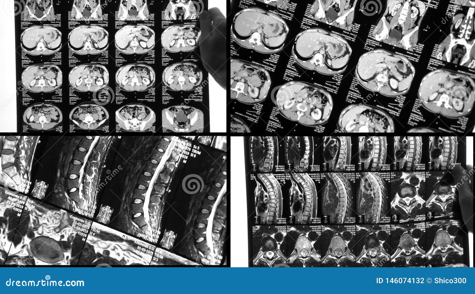 The Doctor`s See Problem Areas of the Back on the MRI Scan or X-Ray ...