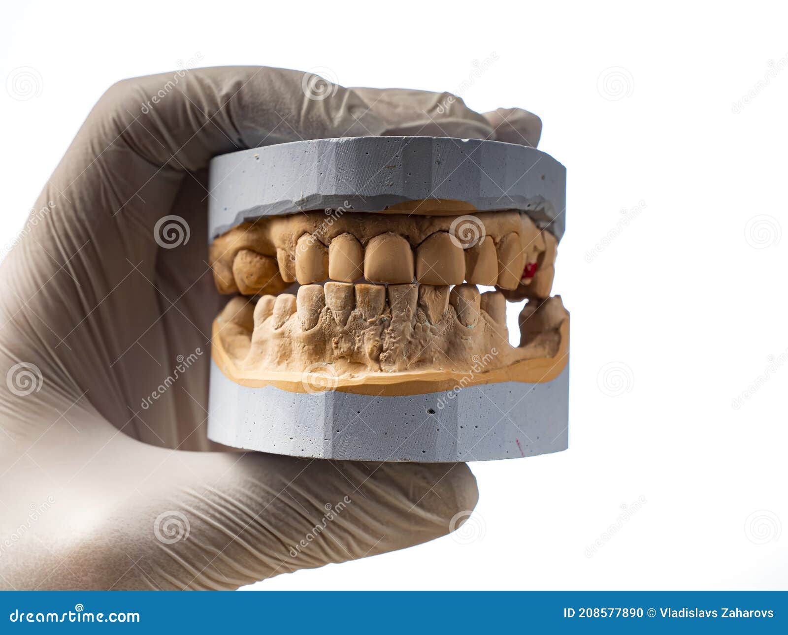 Doctor Shows an Impression of the Jaw Stock Photo - Image of diversity ...