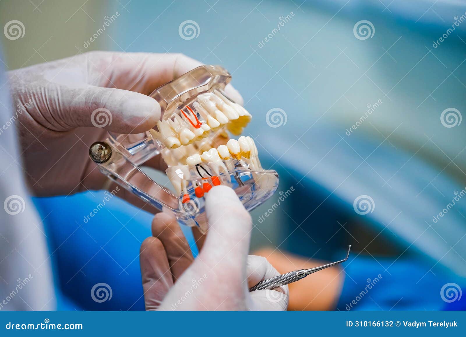 Doctor Shows on a Plastic Jaw Sample or Model Different Methods of ...