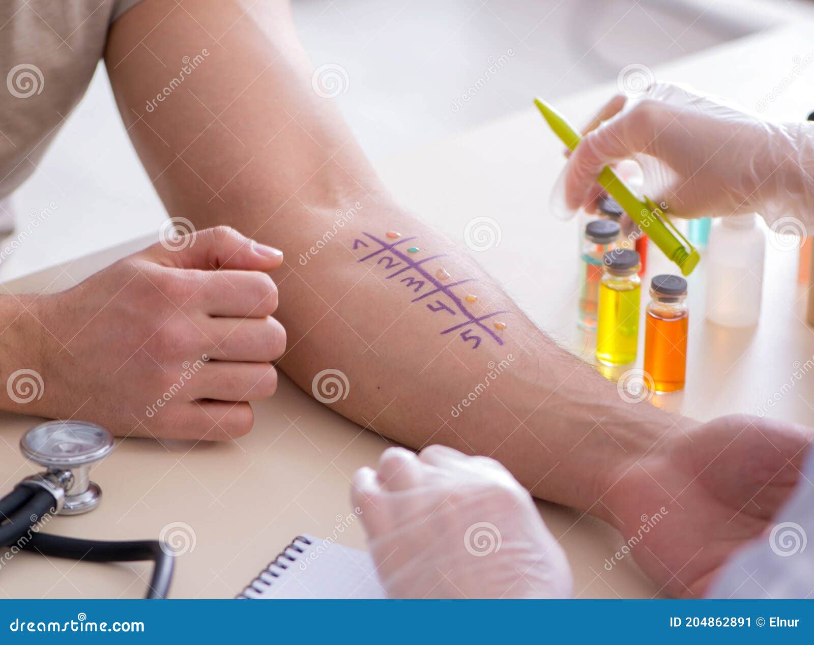 Doctor Testing Allergy Reaction of Patient in Hospital Stock Image ...