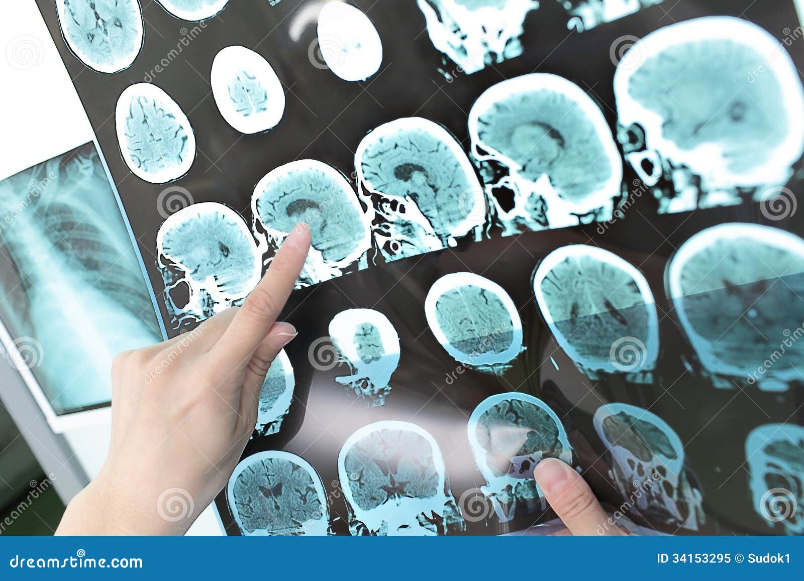 Doctor View Output CT Scan. Stock Image - Image of advanced, hospital ...