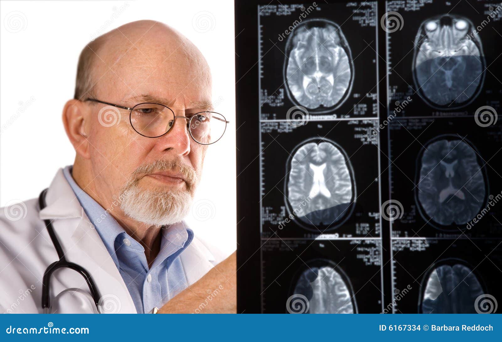Doctor Viewing MRI Films stock photo. Image of scrubs - 6167334