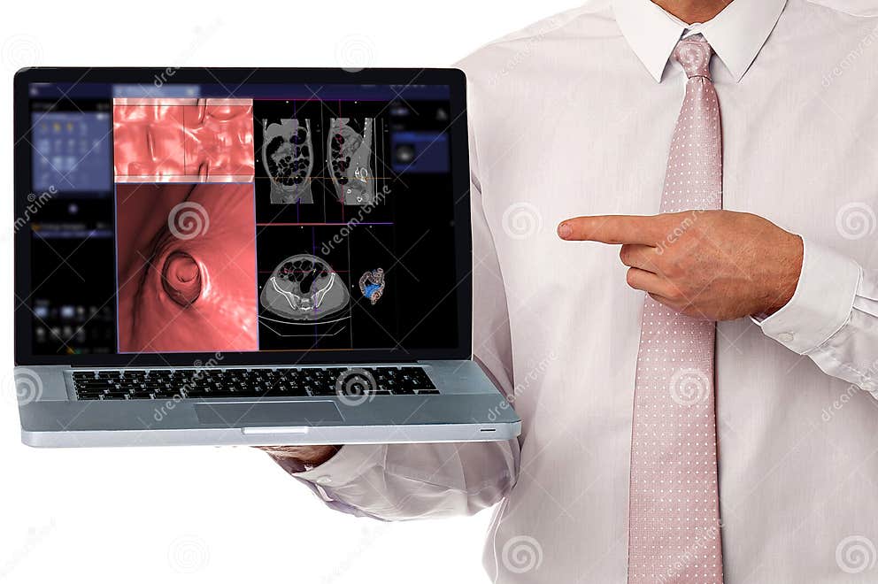 Doctor Working With Notebook Showing Ct Colonography Or Ct Scan Of
