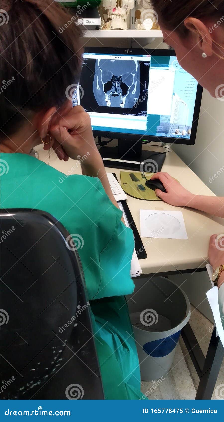 Doctors Checking MRI on on the Screen Editorial Image - Image of ...