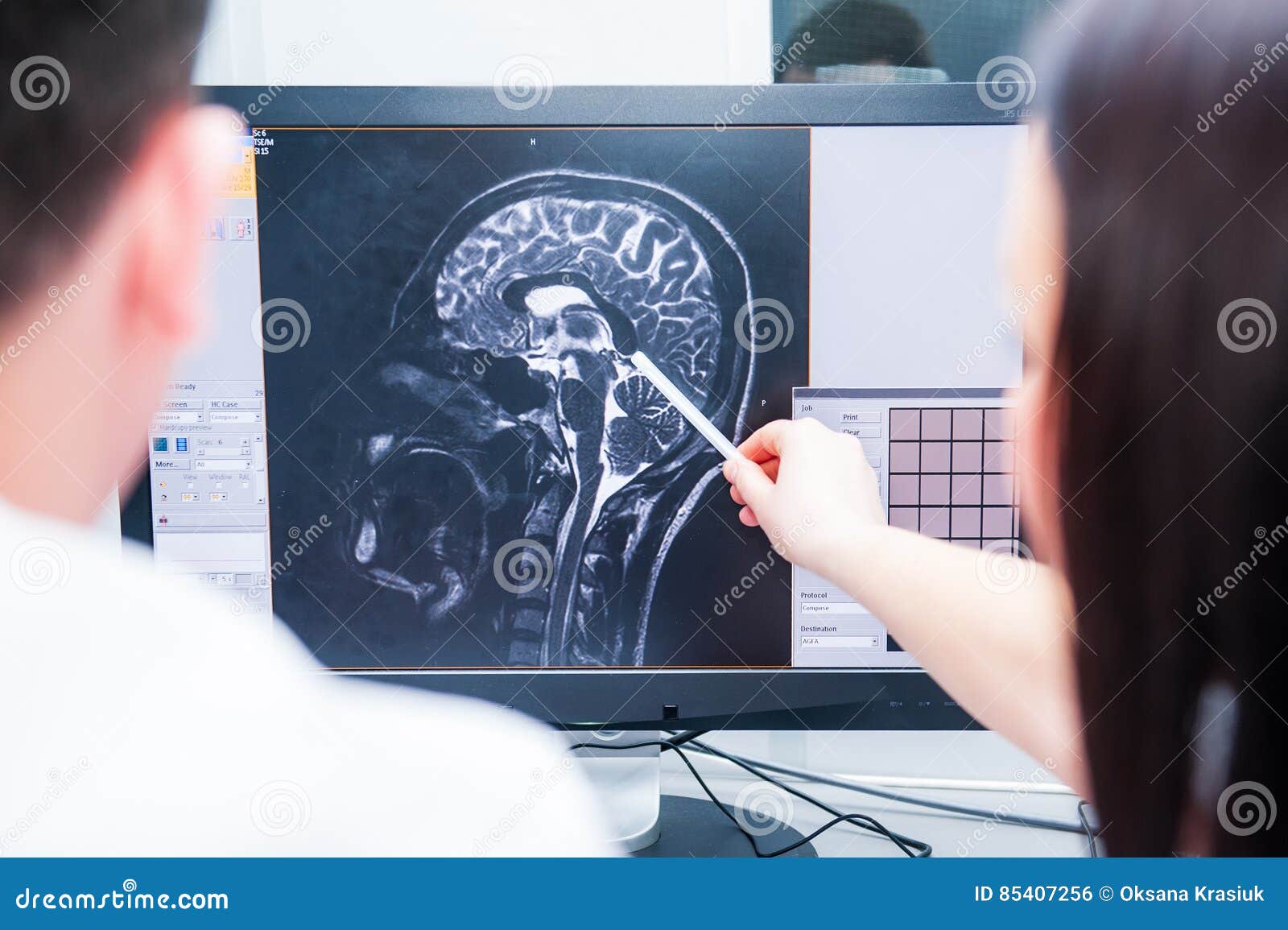 Doctors Consider and Discuss Magnetic Resonance Image MRI of the Brain ...