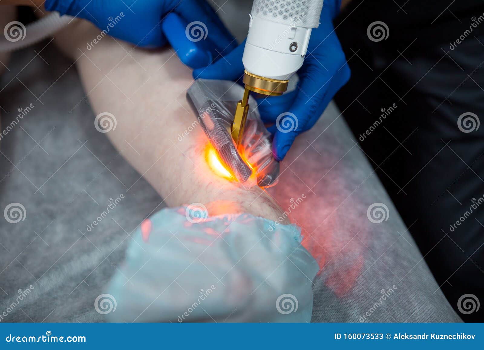 Doctors Doing Vein Surgery Procedure Stock Image - Image of phlebology ...