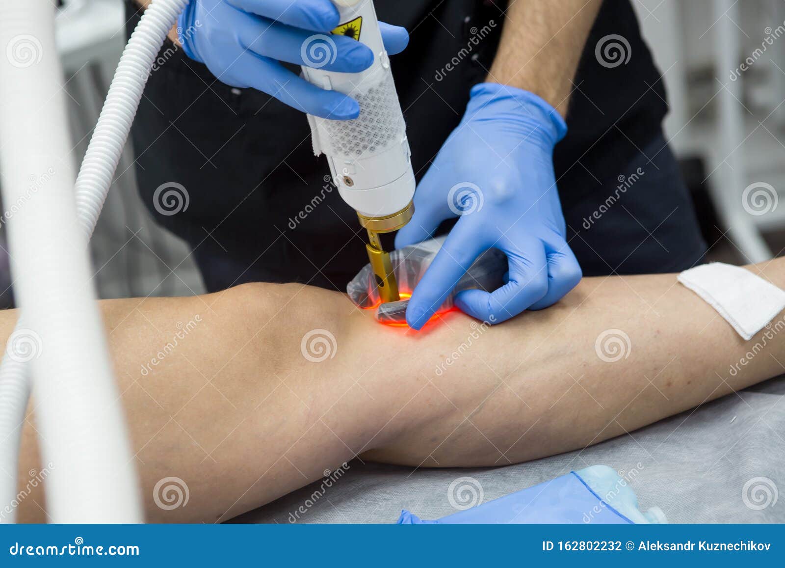 Doctors Doing Vein Surgery Procedure Stock Photo - Image of treatment ...