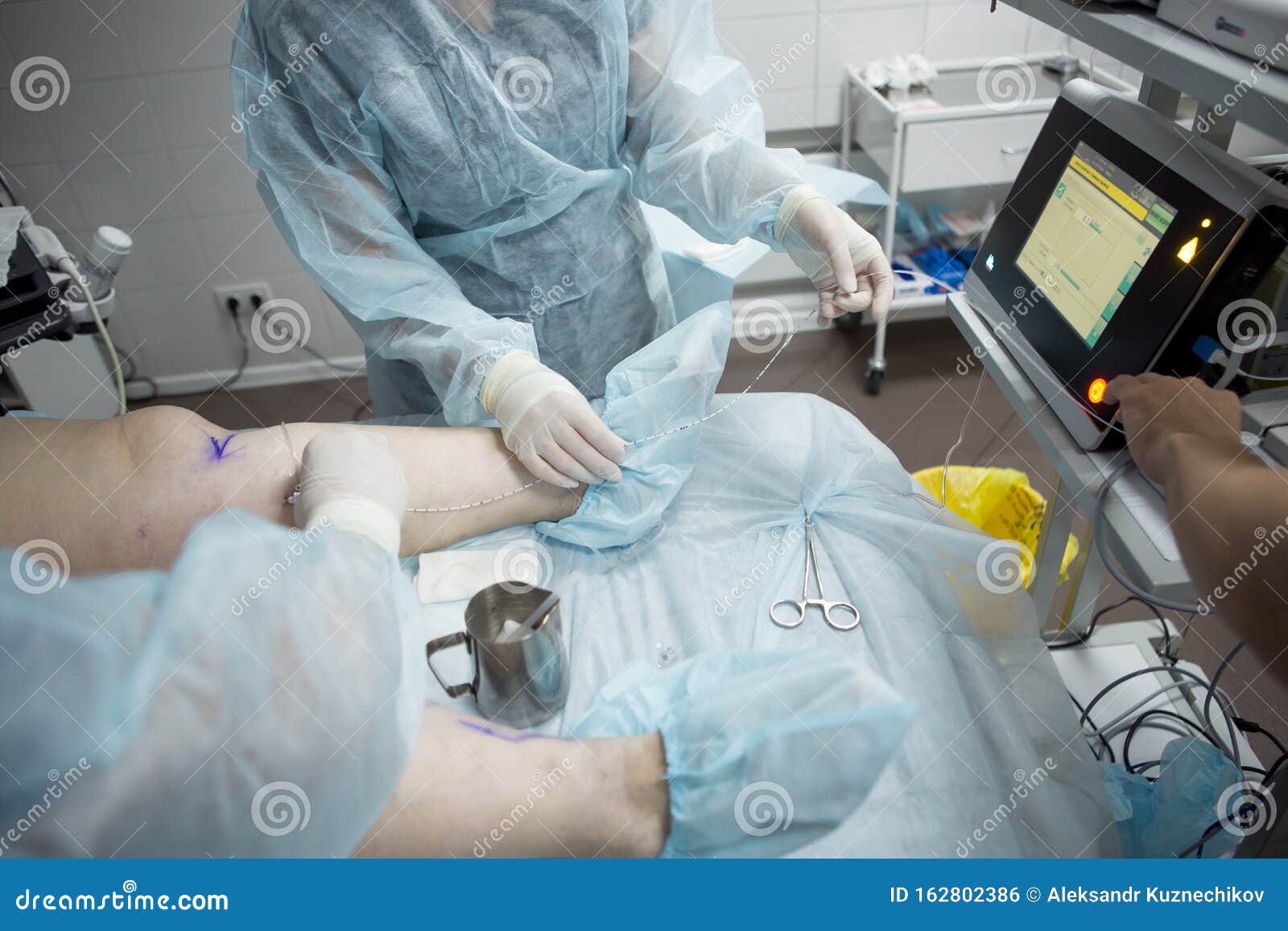 Doctors Doing Vein Surgery Procedure Stock Photo - Image of central ...