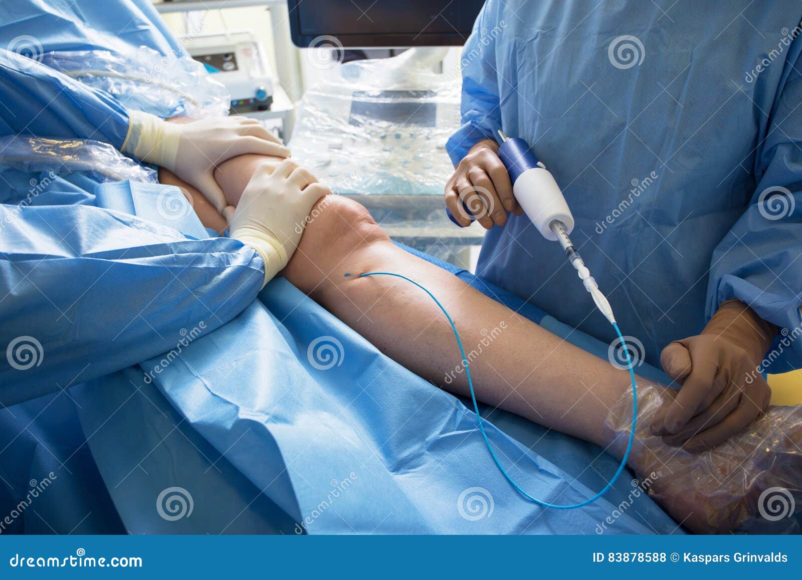 Doctors Doing Vein Surgery Procedure Royalty-Free Stock Image ...