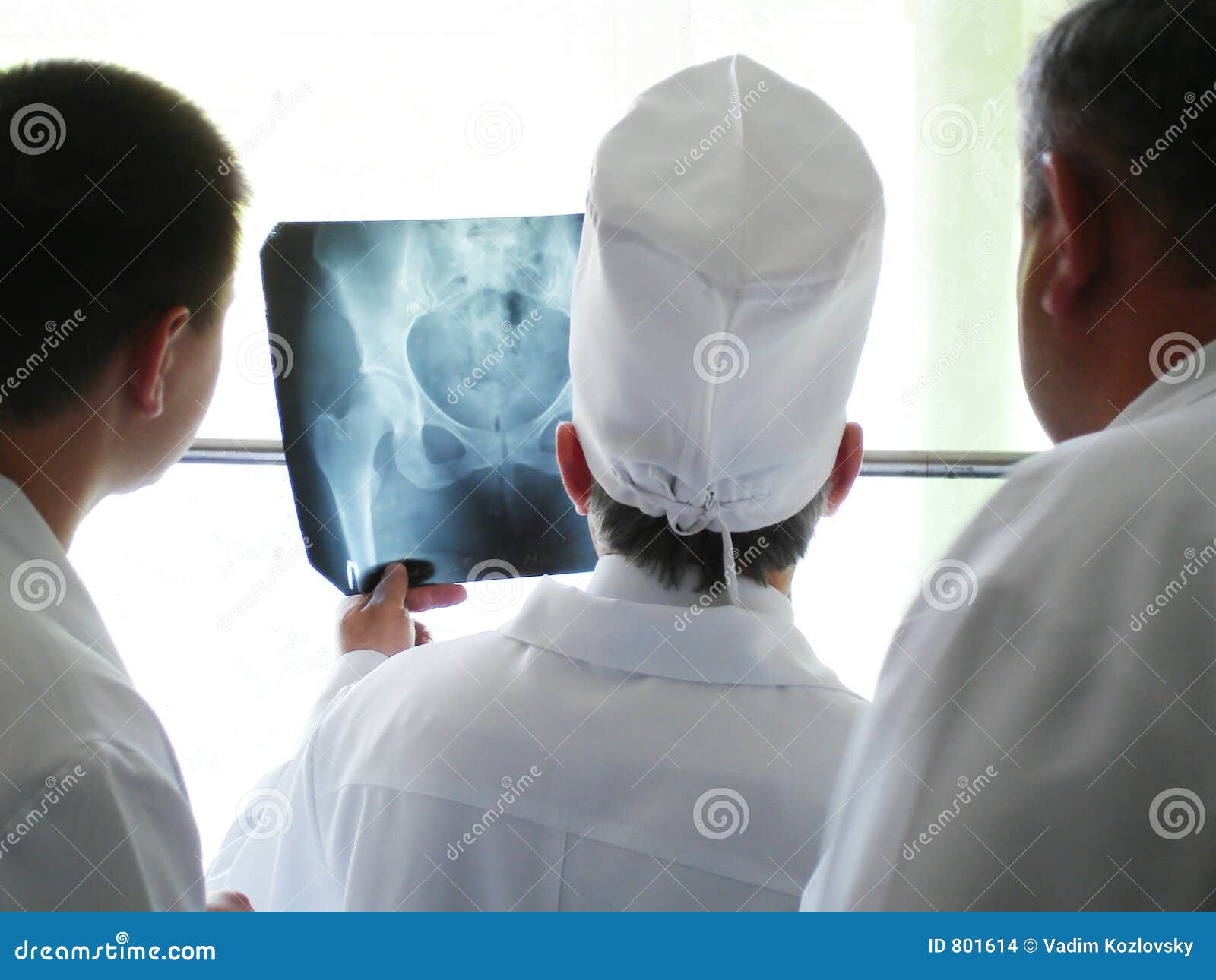 Doctors Examine X-ray Picture Stock Photo - Image of correction ...