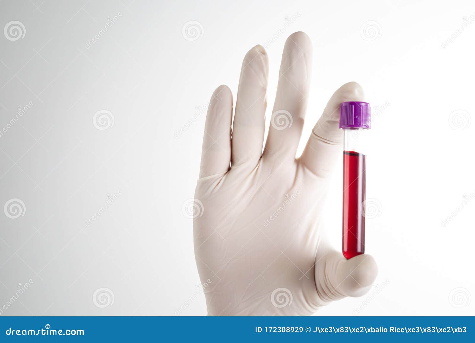 Doctors Hand with Blood Sample in Front of a Medical Laboratory Stock ...