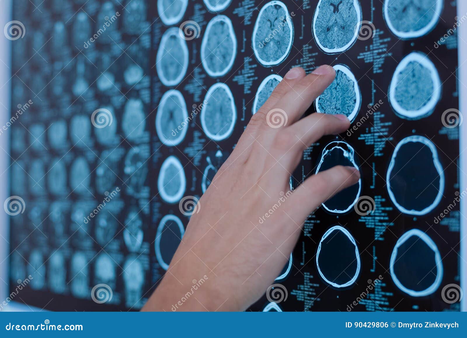 Doctors Hand Pointing at the Brain Photo Stock Photo - Image of ...