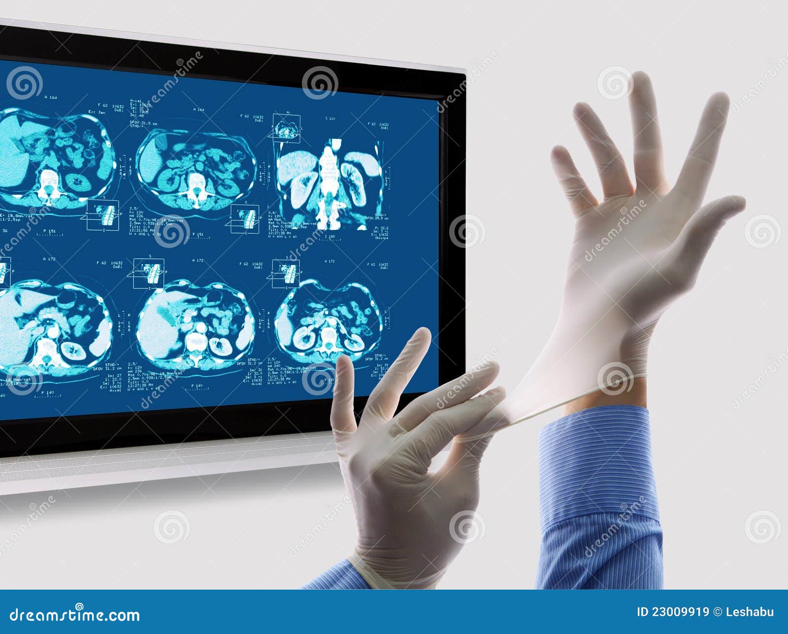 Doctors Hands with MRT Screen Stock Image - Image of help, surge: 23009919