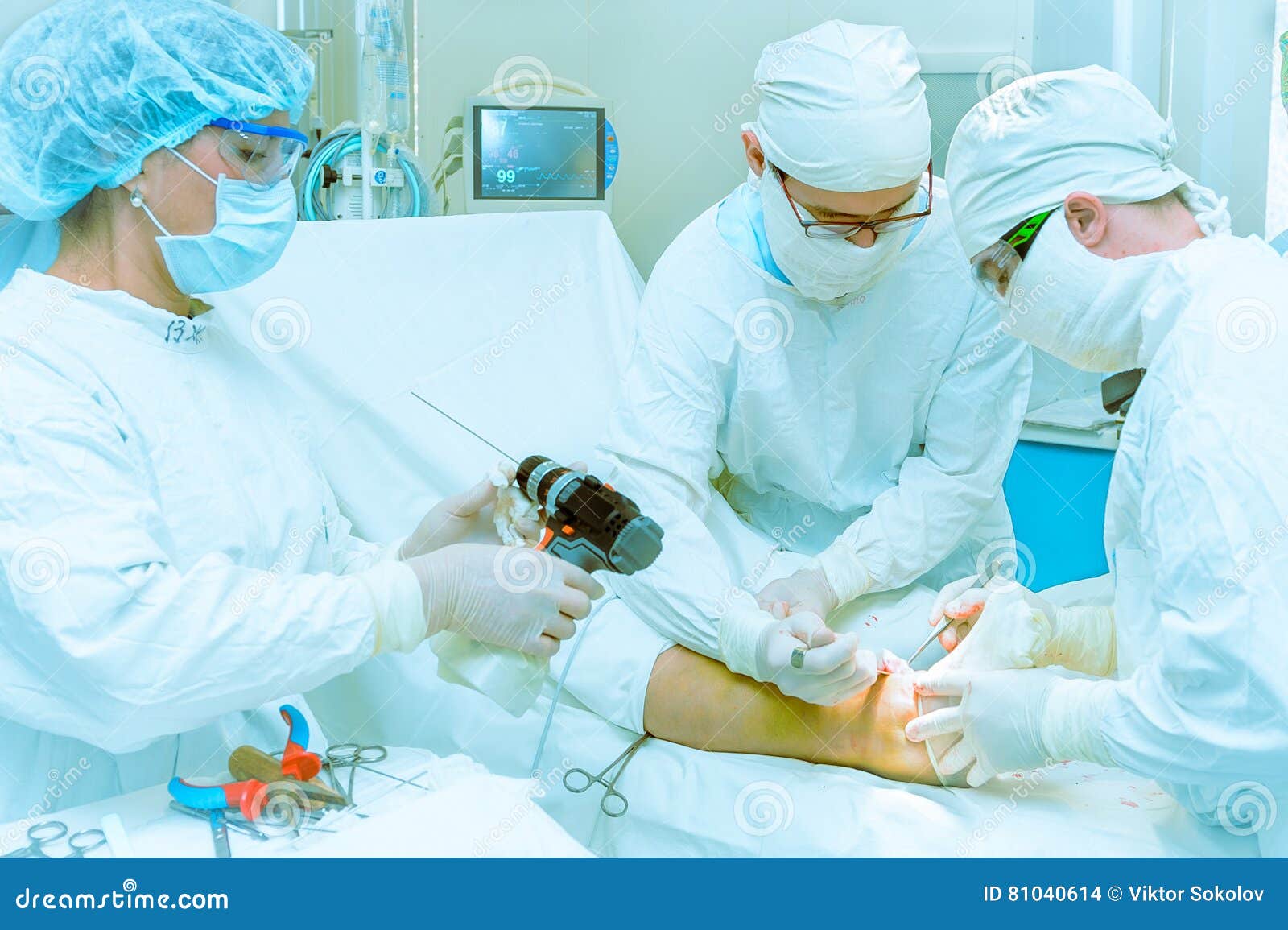 Doctors Operate on a Patient Stock Photo - Image of doctor, treatment ...